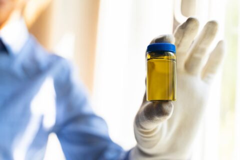 Selles noires : ce que vous devez savoir pour votre santé